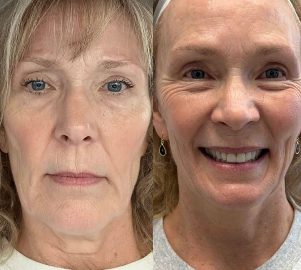 Gallery | St. Louis Vascular Surgical Specialists