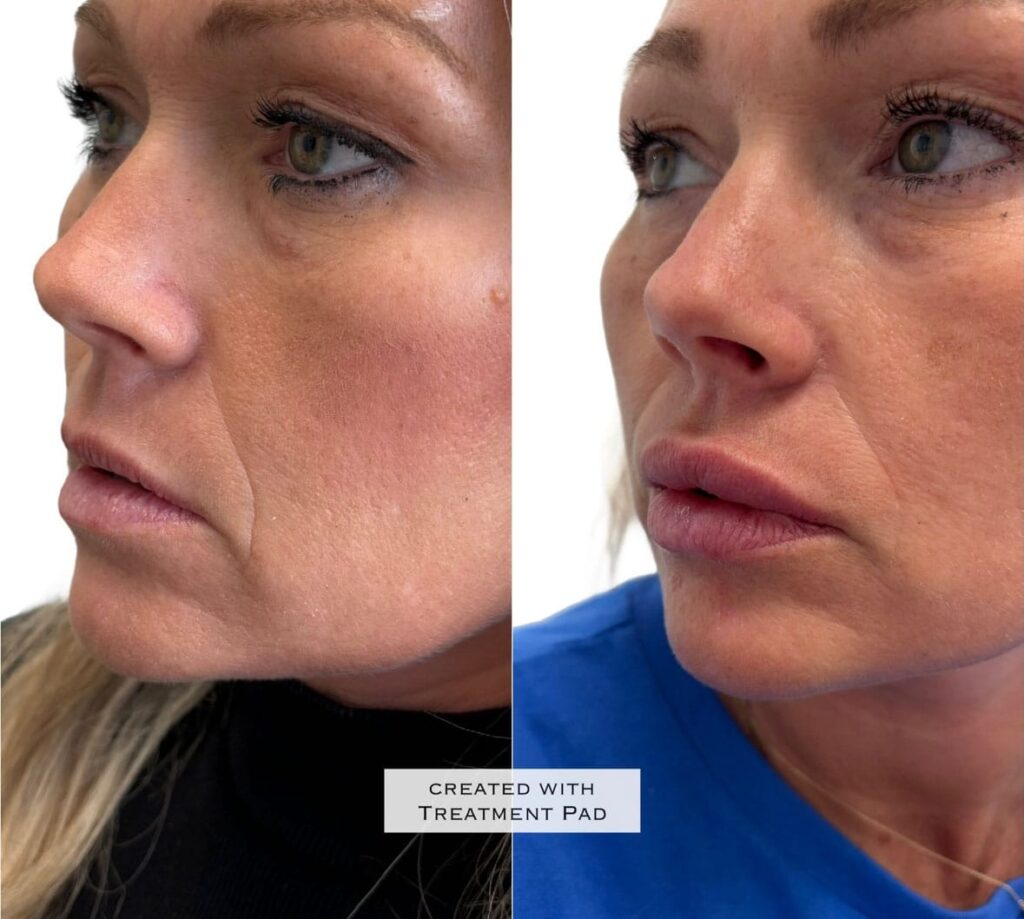 Gallery | St. Louis Vascular Surgical Specialists