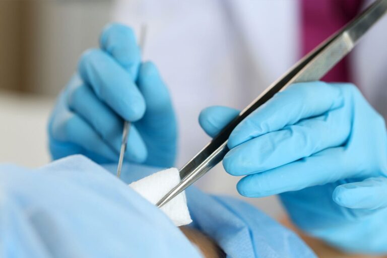 Wound Care in St, Louis, MO | St. Louis Vascular Surgical Specialists