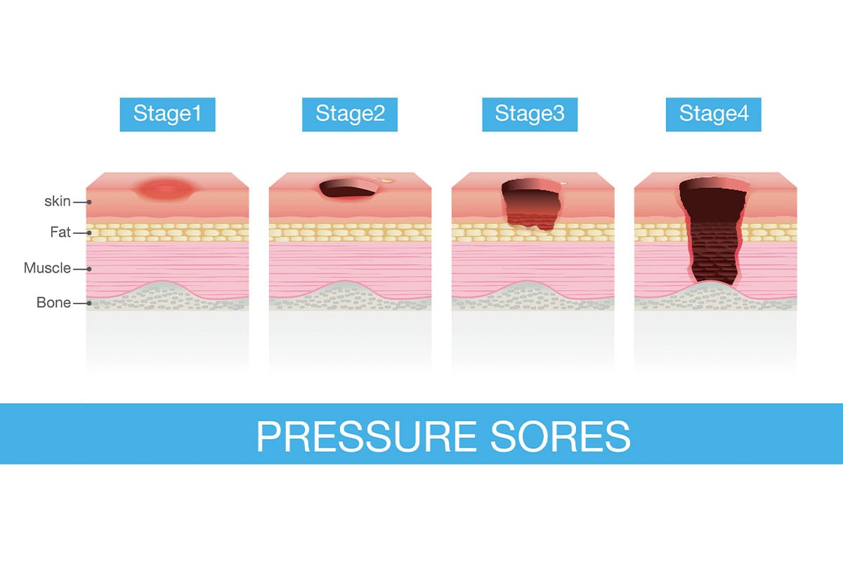 Wound Care St. Louis, MO | St. Louis Vascular Surgical Specialists